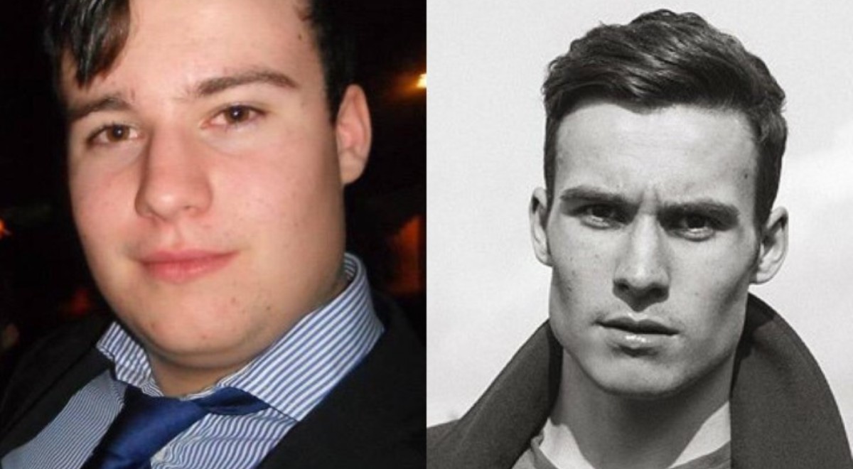 15 personer som förvandlats från "fula ankungar" till vackra svanar ...