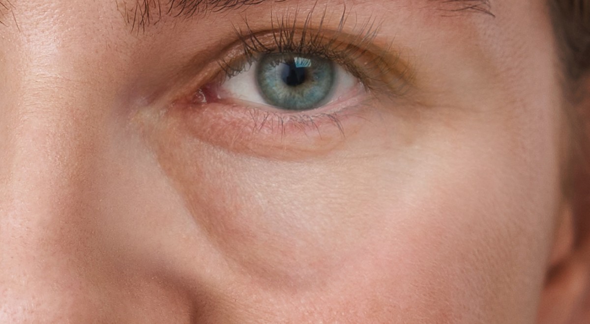 Les poches sous les yeux : un sommeil réparateur peut-il les faire ...