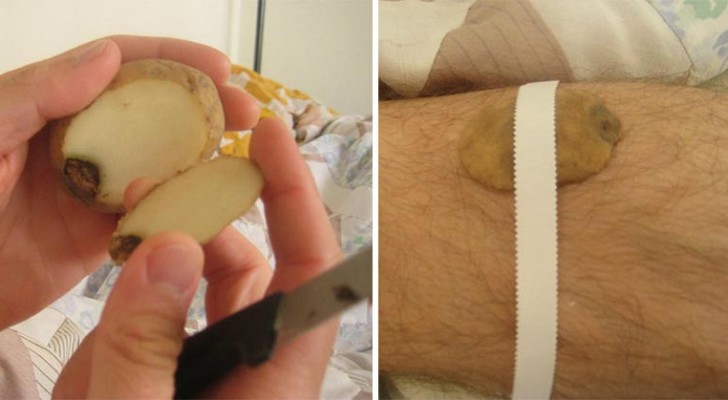 In deze 9 gevallen heb je behandeling nodig voor een insectenbeet ...